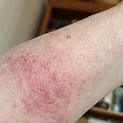 Amazon.com: ZANFEL - Poison Ivy, Oak & Sumac Wash, 1 Oz: Health ...