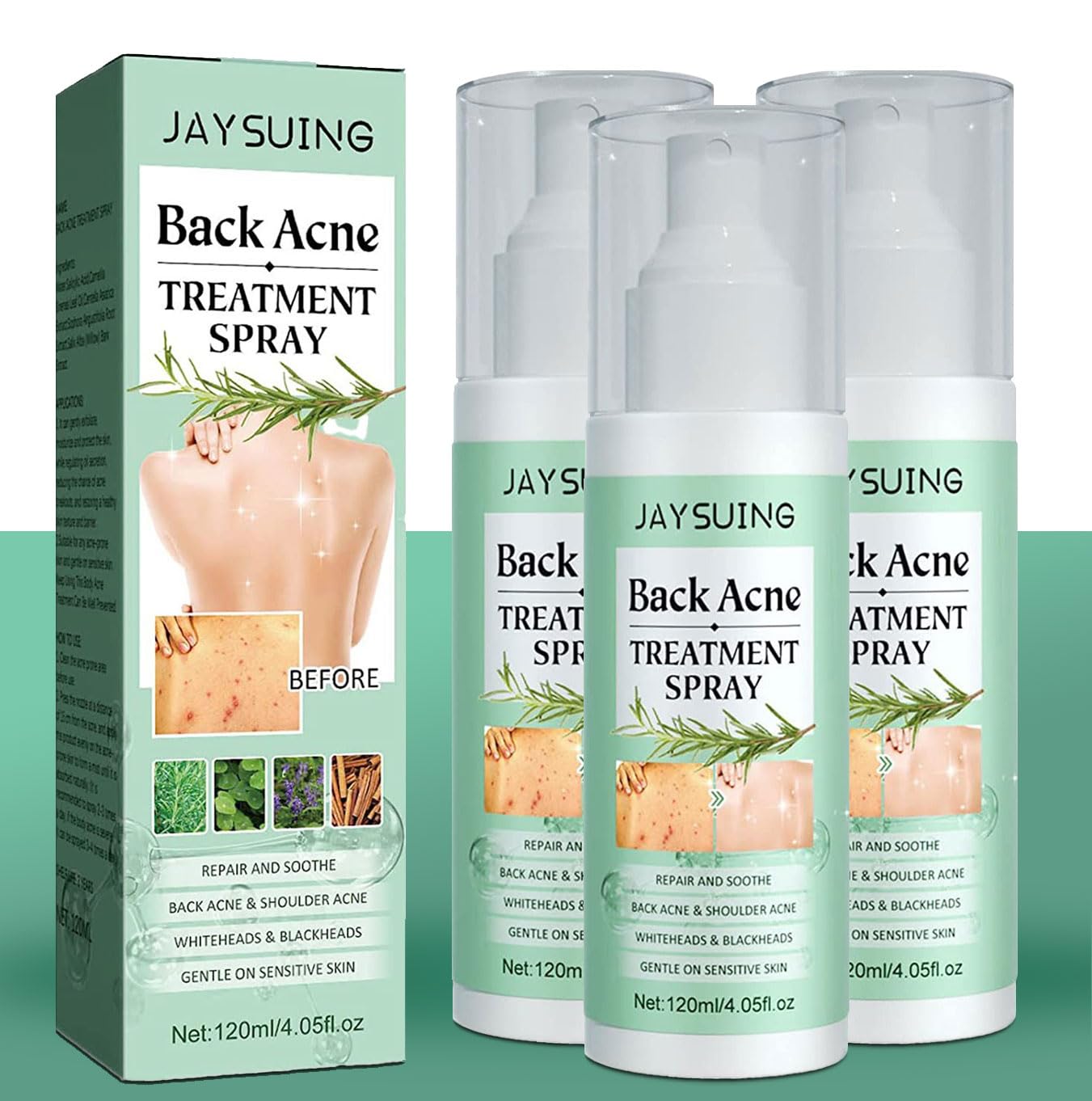 Mua 3 Pack Back Acne Treatment, Back Acne Spray, 2% Salicylic Acid ...