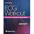 ECG Workout: Exercises in Arrhythmia Interpretation: Huff, Jane ...