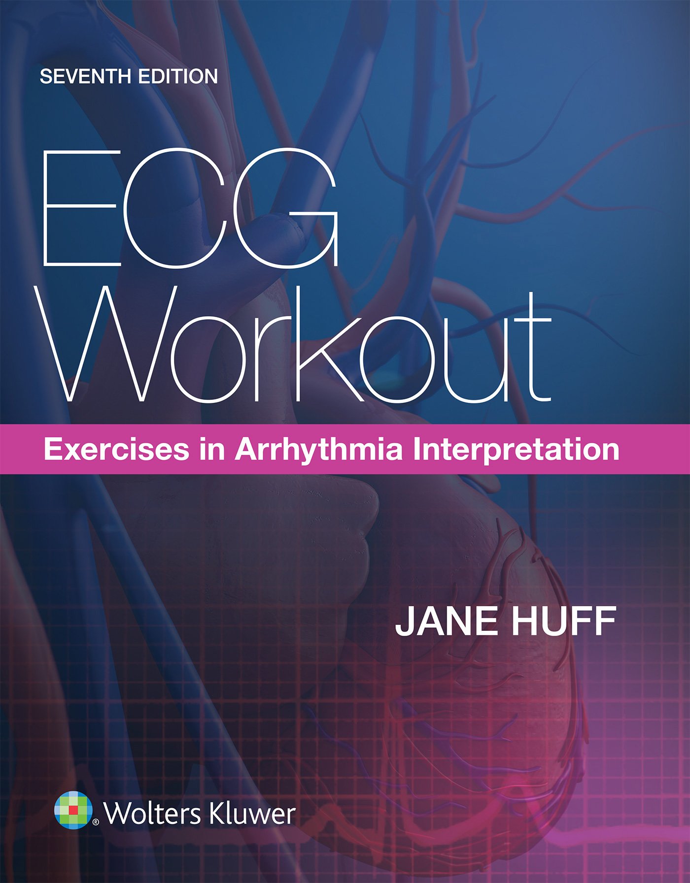 ECG Workout: Exercises in Arrhythmia Interpretation – starkidslearn.com