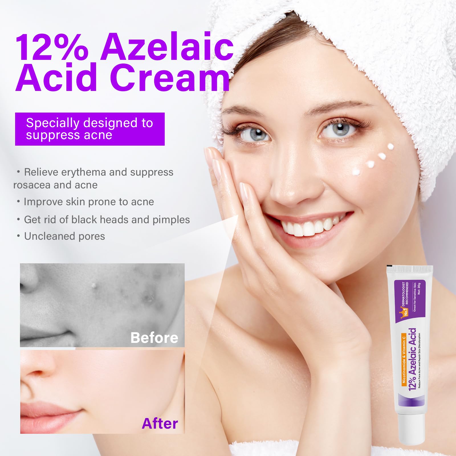 Mua Azelaic Acid Serum, Azelaic Acid 12% Acne Treatment Facial Cream ...