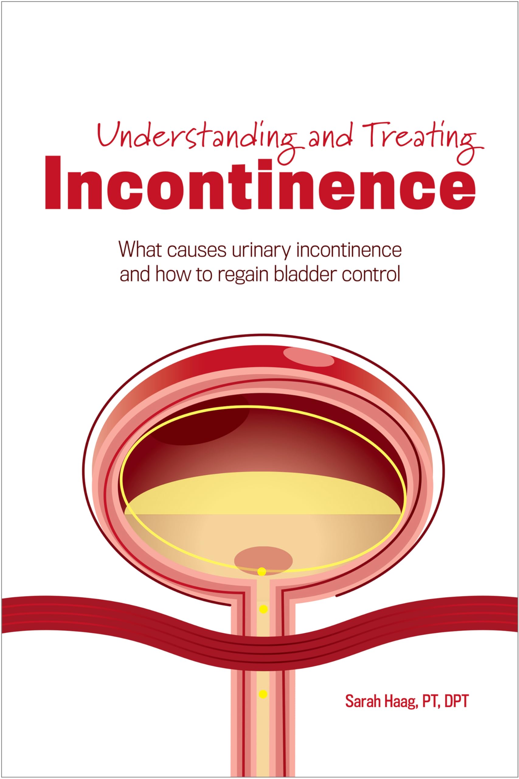 Understanding and Treating Incontinence: What Causes Urinary ...