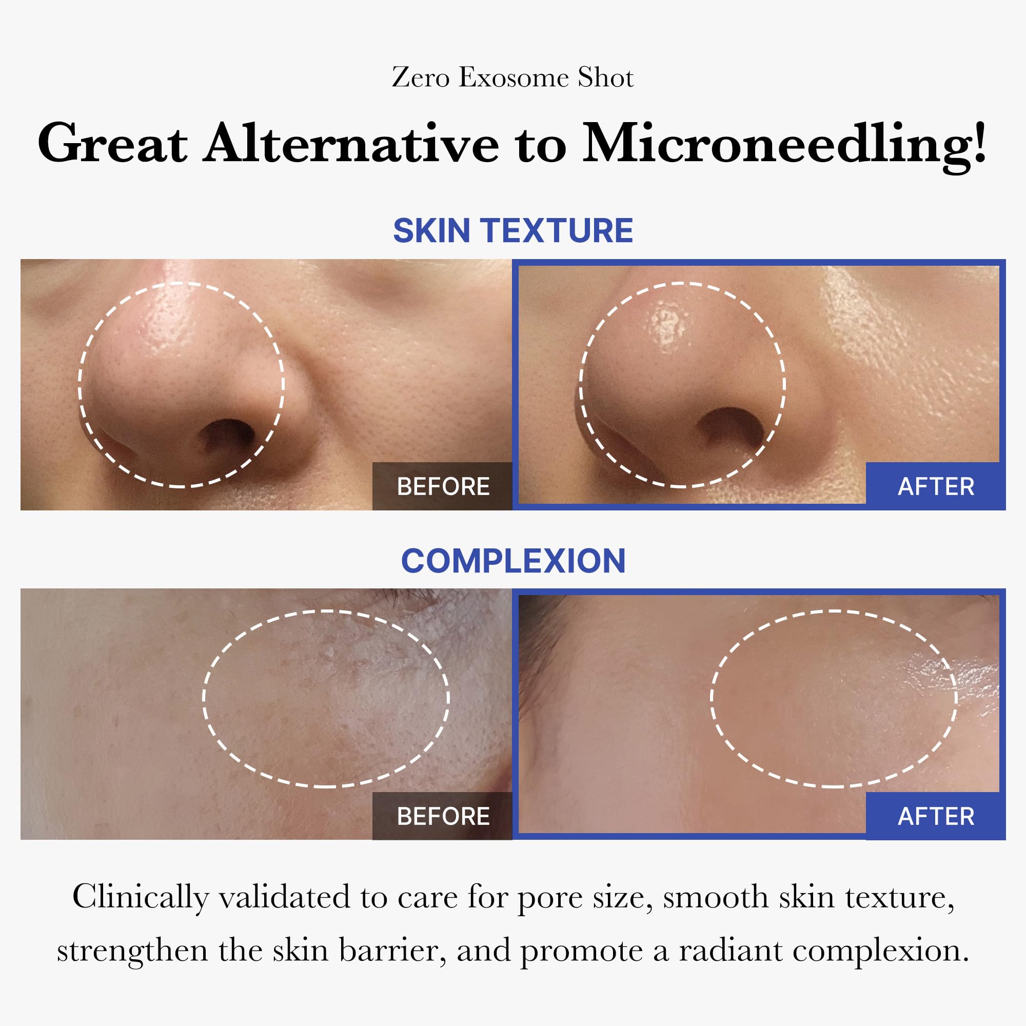 Mua Medicube Zero Exosome Shot 7,500 PPM Spicule Facial Serum | Liquid ...