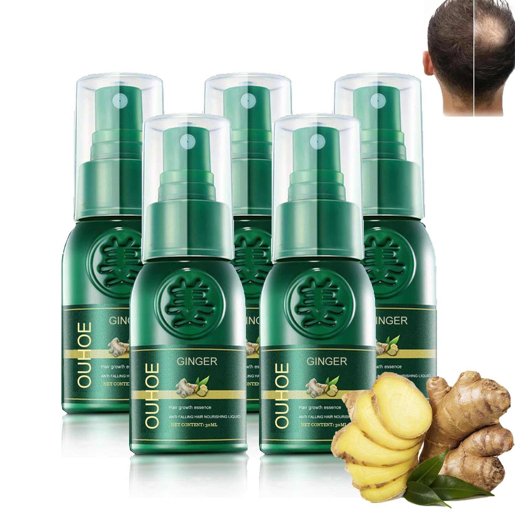 Mua Oveallgo Shougagro Japanese Hair Growth Spray, Japanese Hair Growth ...