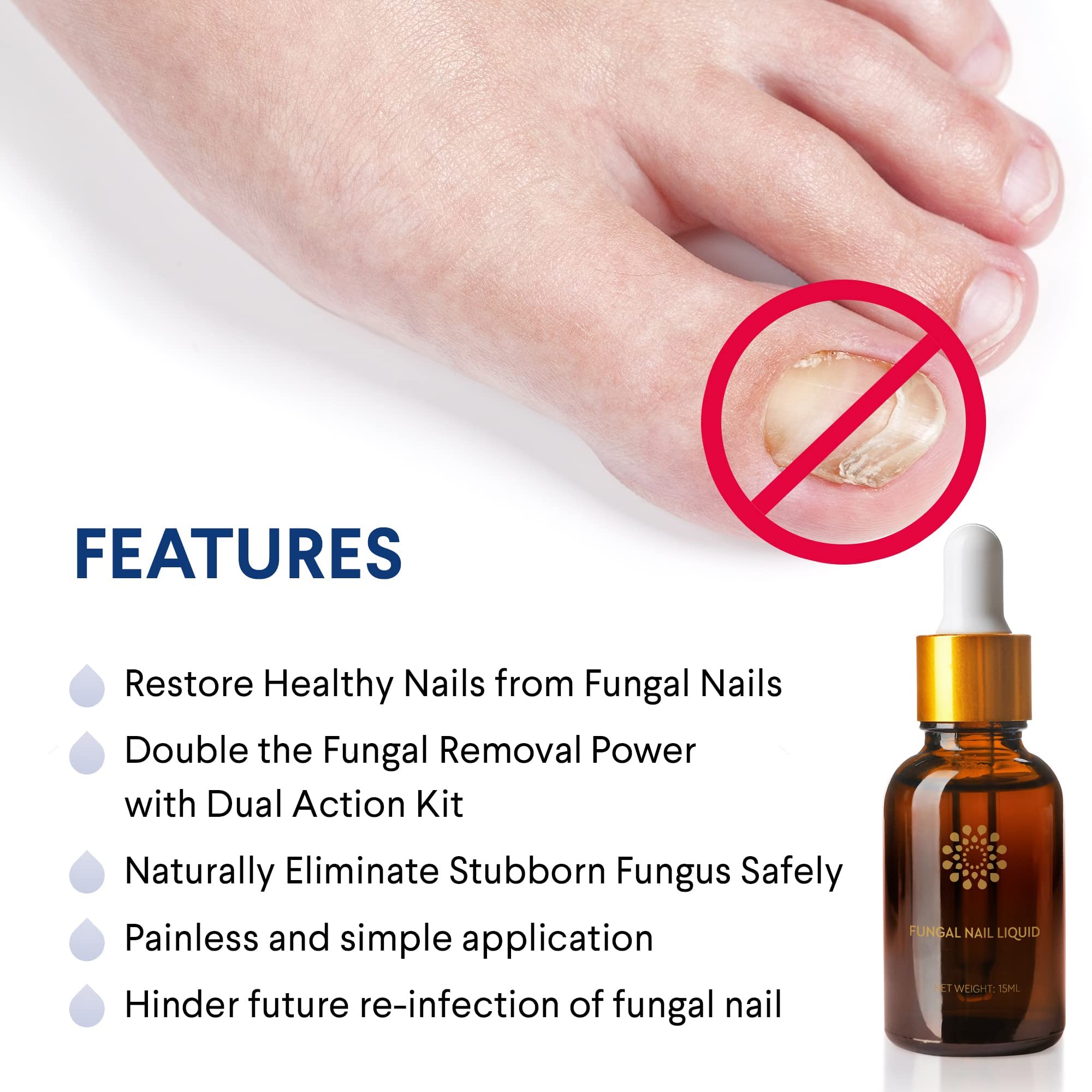 Mua Bestkiss Toenail Fungus Treatment Extra Strength: Nail Fungus ...
