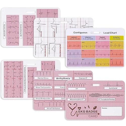 EKG Cardiac Badge Card 3 Card Set, Stemi Badge Card EKG Telemetry ...