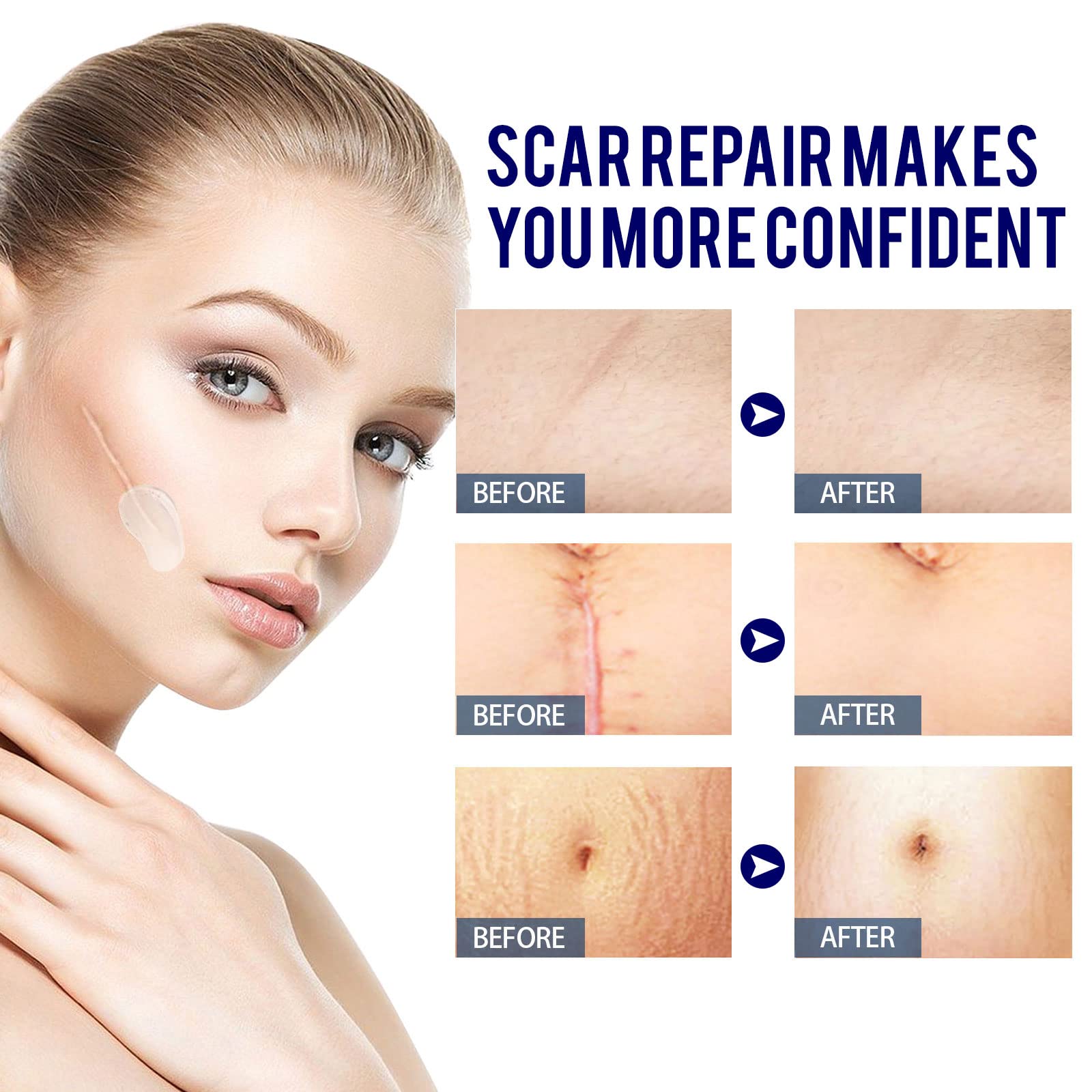 Mua Scar Cream Gel - With Retinol, Allantoin, Vitamin E, Advanced Scar ...