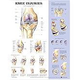 Amazon.com: Palace Learning Laminated Anatomy and Injuries of the Knee ...