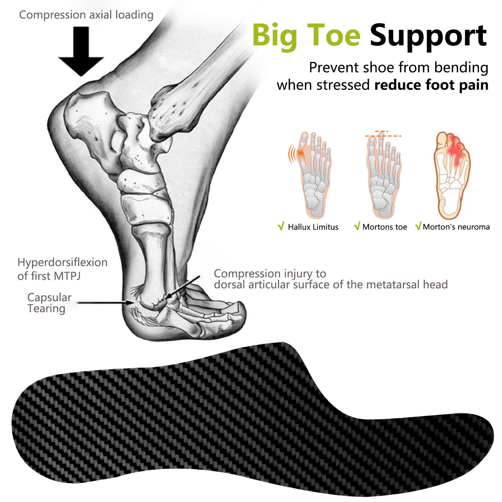 Mua Morton's Extension Orthotic, Carbon Fiber Insole (1 Piece), Rigid ...