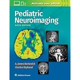 Pediatric Neuroimaging (Pediatric Neuroimaging (Barkovich ...