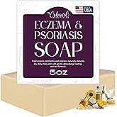 Amazon.com : Eczema Soap Bar for Face and Body – All Natural Dermatitis ...