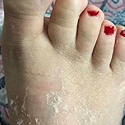 Footner Exfoliating Socks, Foot Mask, Foot Peel, At Home Pedicure to ...
