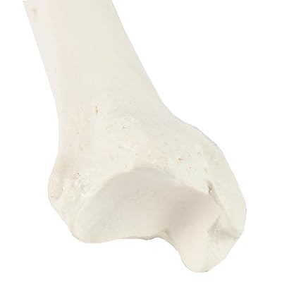 Left 3 Year Warranty Axis Scientific Patella Bone Model Cast from a ...