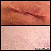 Science of Skin Solution for Scars: Amazon.co.uk: Beauty