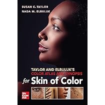 Boda De Susan Taylor Amazon.com: Joy Susan Women's Taylor Oversized