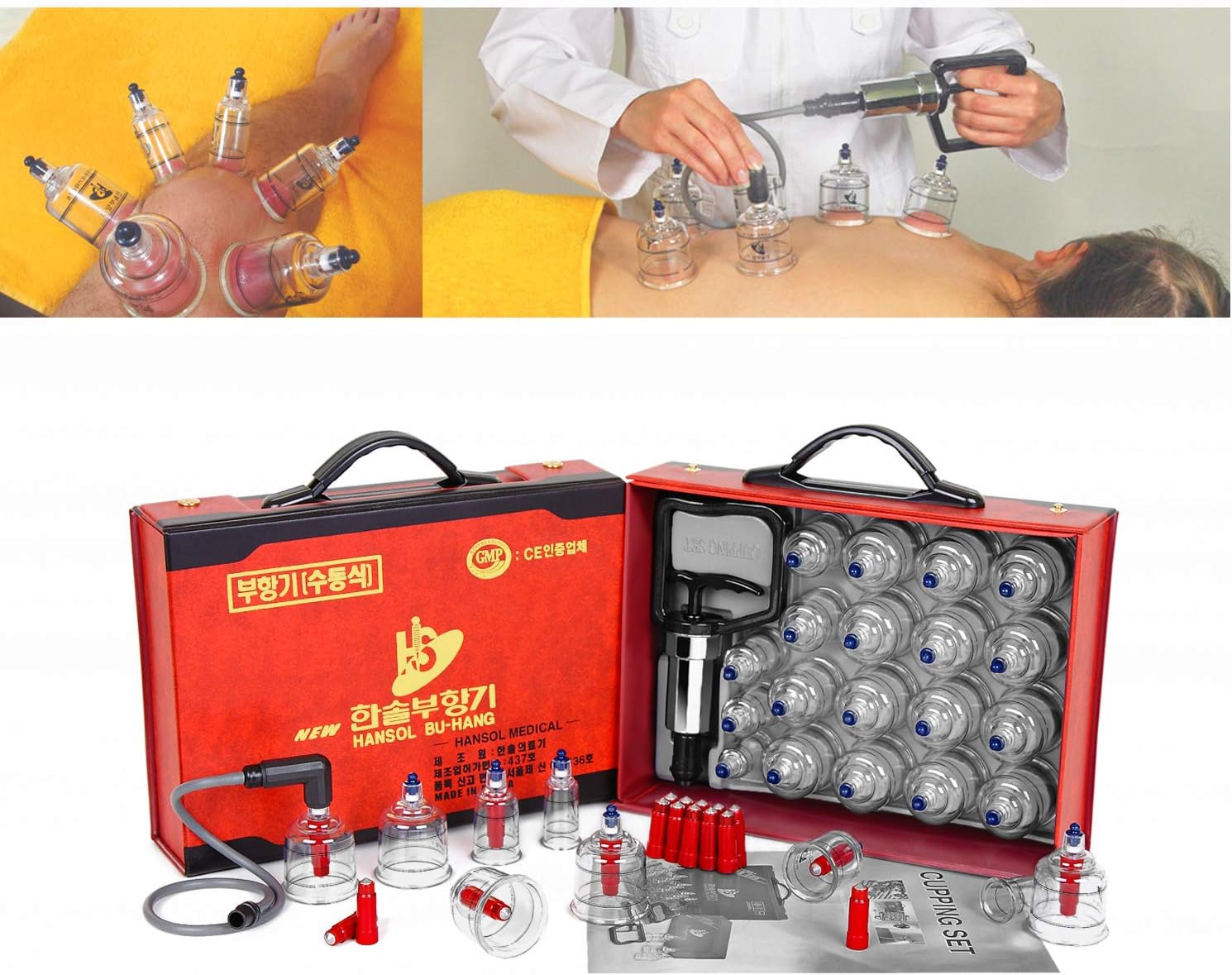 19 PCS Premium Cupping Set – HANSOL MEDICAL – BigaMart