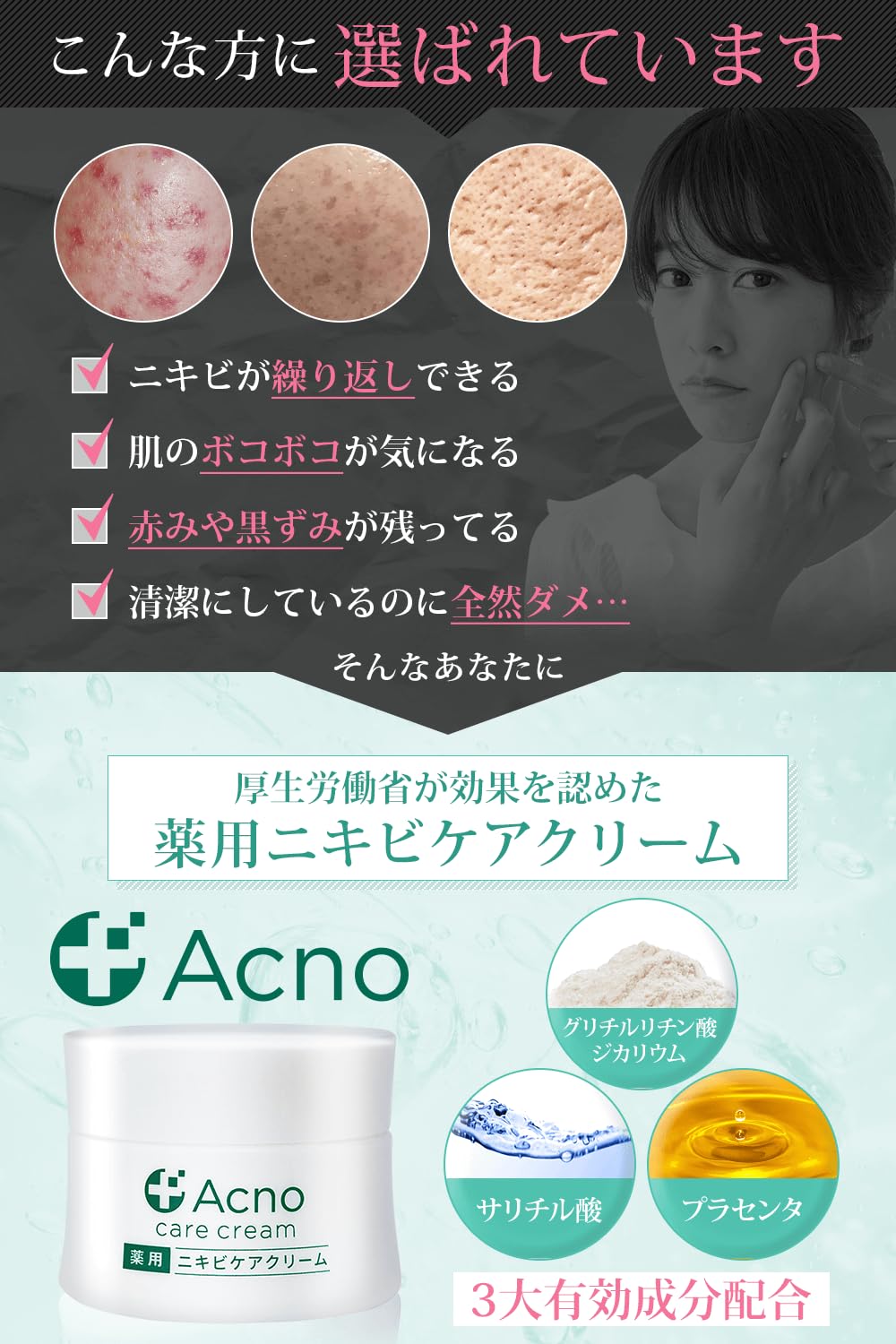 Mua ACNO Acne Care Cream All-in-One Gel for Adult Acne, Back, Butt, Acne, Acne, Face, Body ...