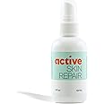 Amazon.com: Active Skin Repair Spray - Natural & Non-Toxic First Aid ...
