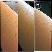 Amazon.com : Rough and Bumpy Smoothing Skin Lotion | Best to Smooth ...