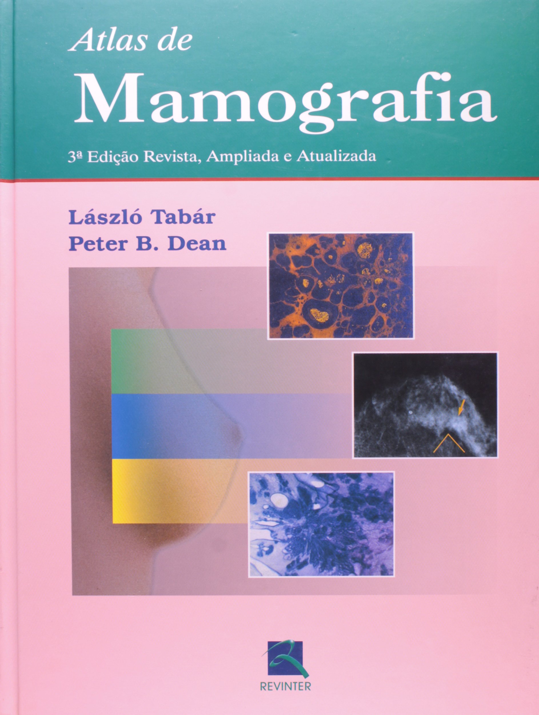 Atlas De Mamografia PDF Laszlo Tabar