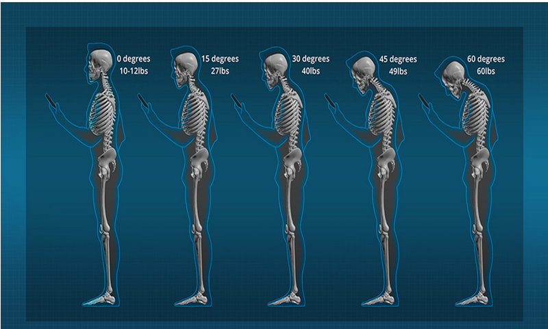 Forward Head Posture:Amazon.com:Appstore for Android