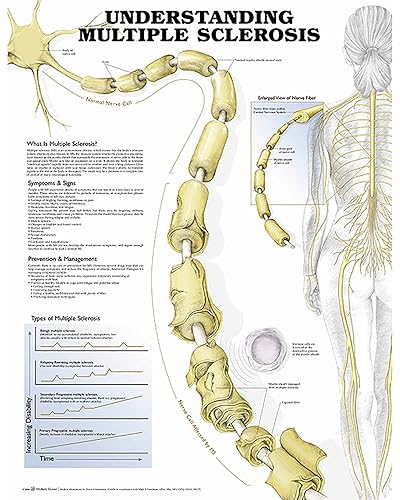 Understanding Multiple Sclerosis Anatomical Chart in Oman | Whizz Neurology