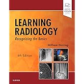 Learning Radiology: Recognizing the Basics: 9780323328074: Medicine ...