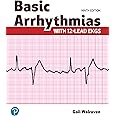 Basic Arrhythmias With 12-Lead EKGs: Walraven, Gail: 9780138164959: Amazon.com: Books