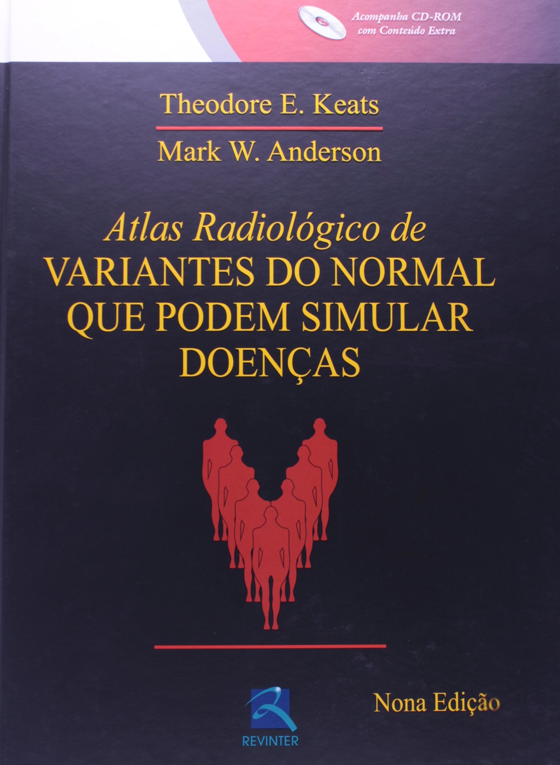 Atlas Radiol.Variantes Normal Que Podem Simular Doencas PDF Keats