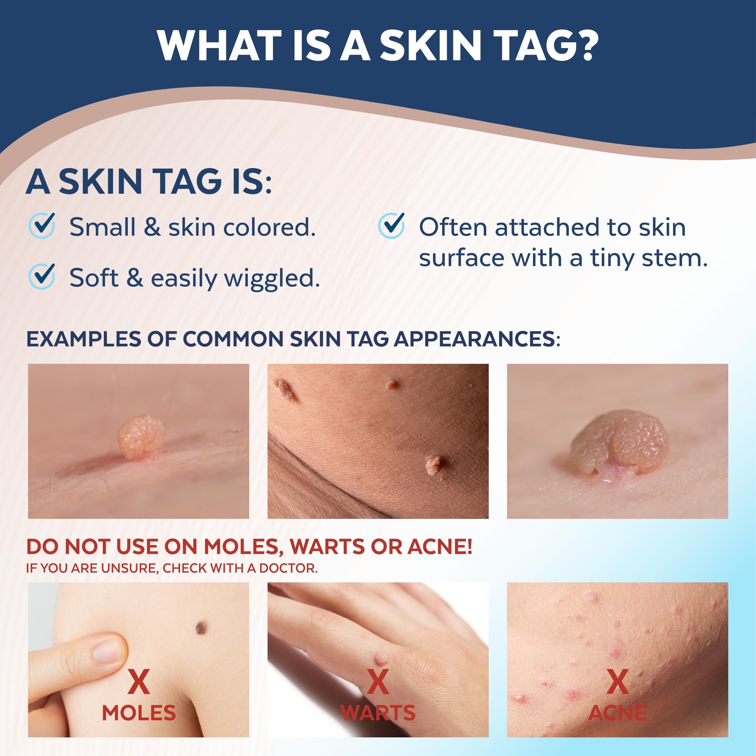 Mua Claritag Advanced Skin Tag Remover - FDA-Cleared Device - Only for ...