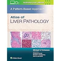 Atlas of Lymph Node Pathology: A Pattern Based Approach: 9781496375544 ...