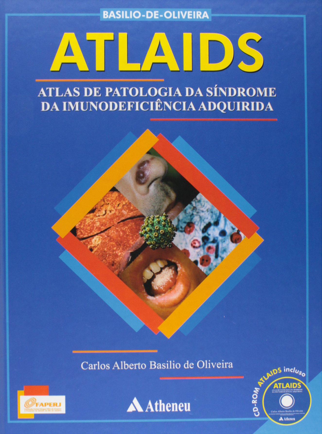 ATLAIDS. Atlas de Patologia da Síndrome da Imunodeficiência Adquirida ...