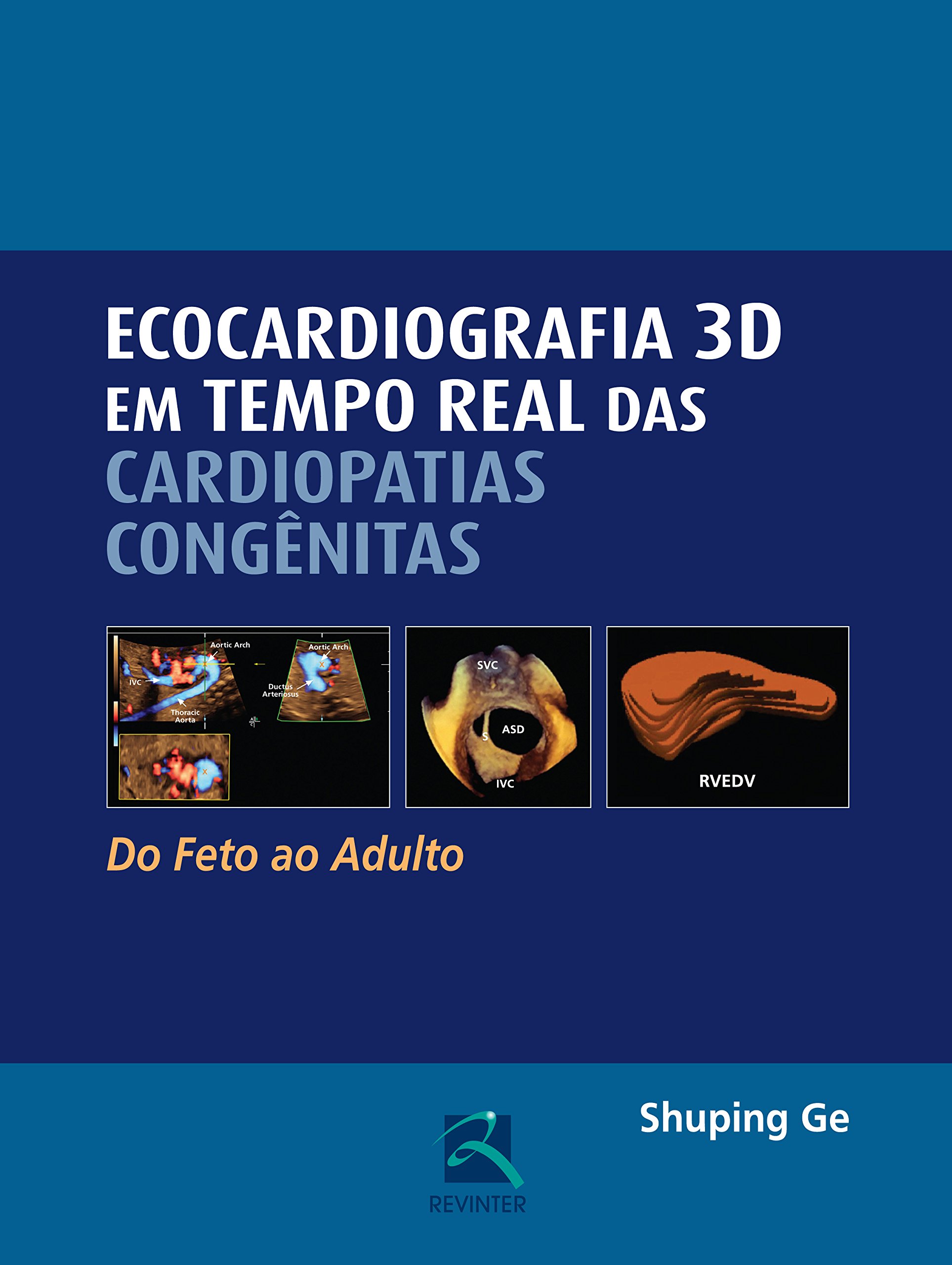 Ecocardiografia 3D em Tempo Real das Cardiopatias Congênitas: do Feto ...