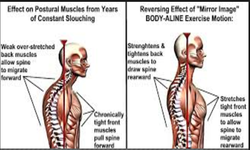 Amazon.com: Forward Head Posture: Appstore for Android