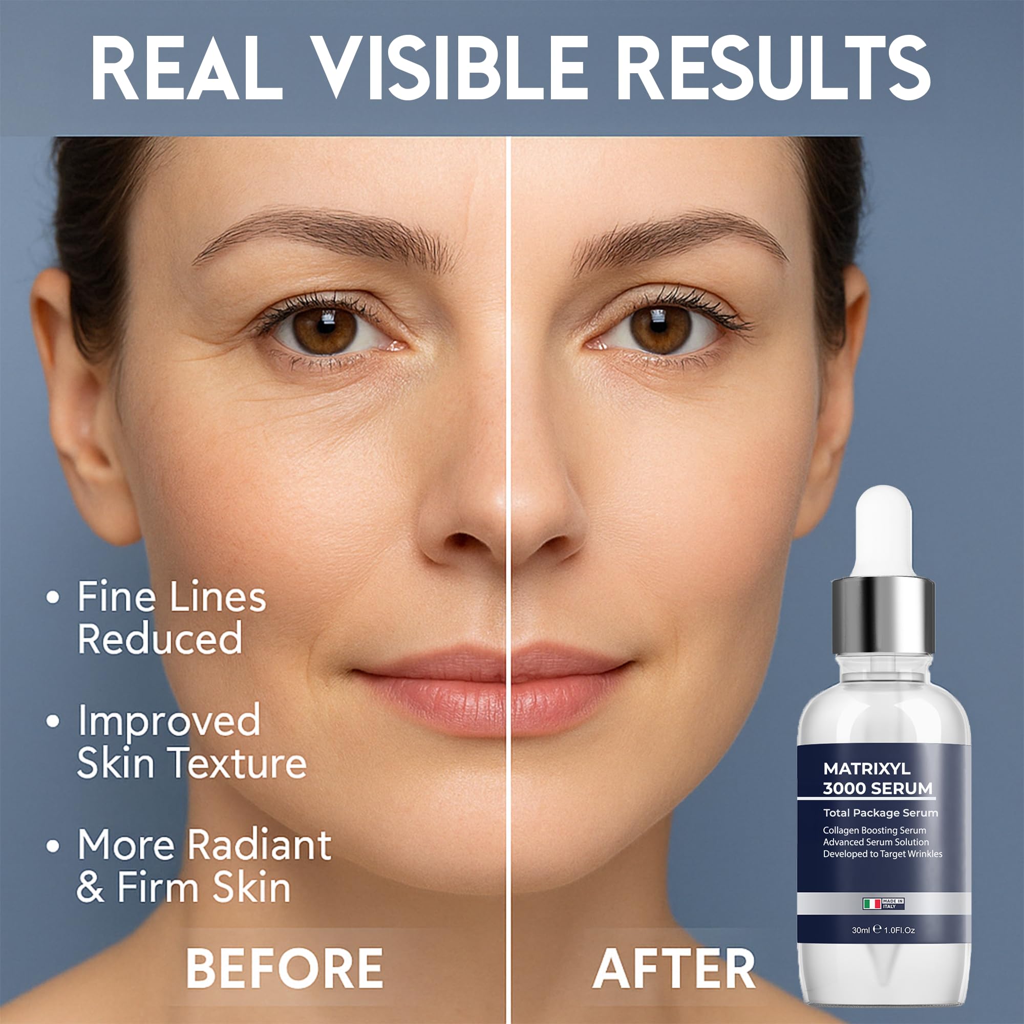 Mua Matrixyl 3000 Total Package Serum with Hyaluronic Acid, Argireline ...