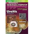 Uveitis (Color Atlas and Synopsis of Clinical Ophthalmology ...
