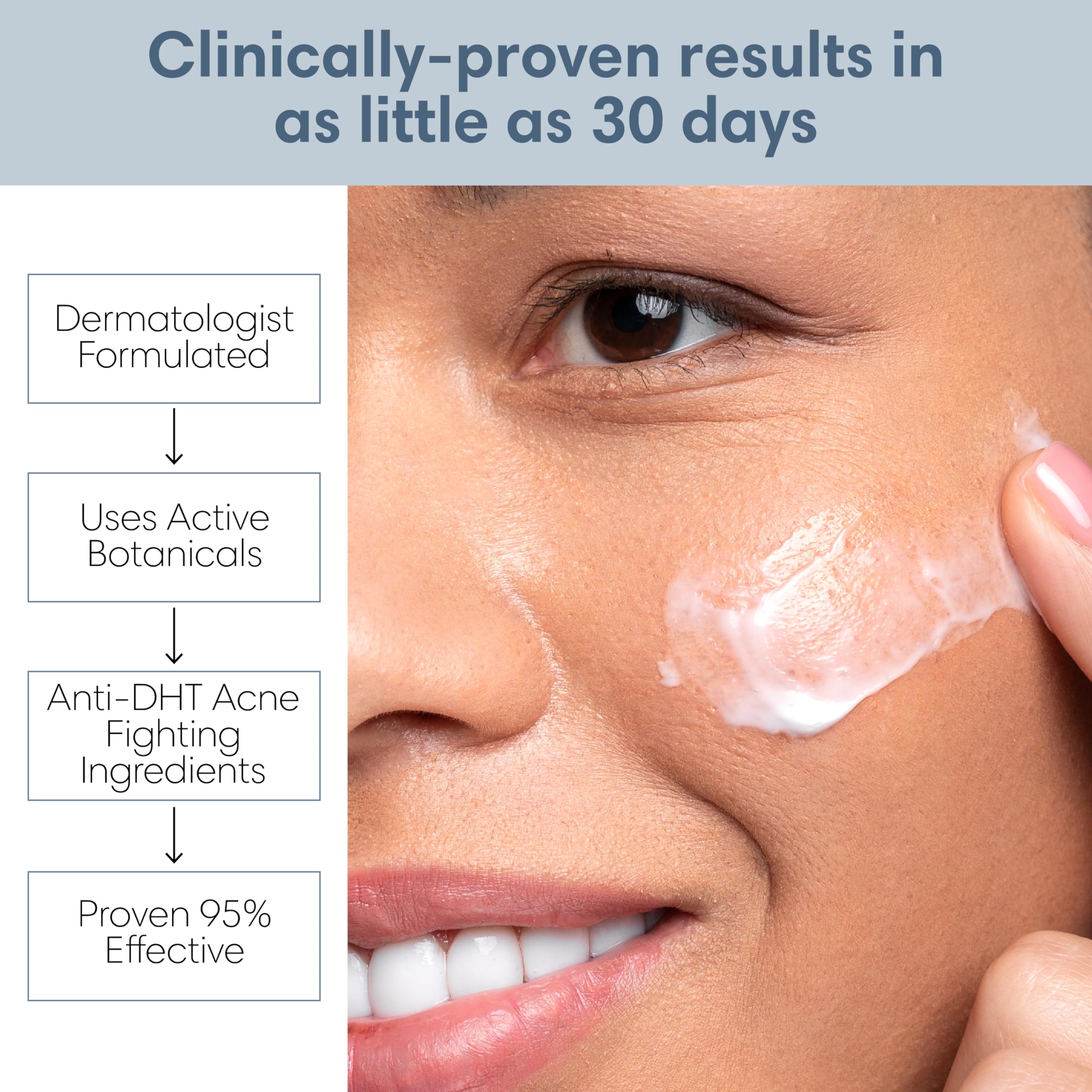 Mua Clearogen Sensitive Skin Sulfur Acne Lotion, Acne Treatment, Sulfur ...