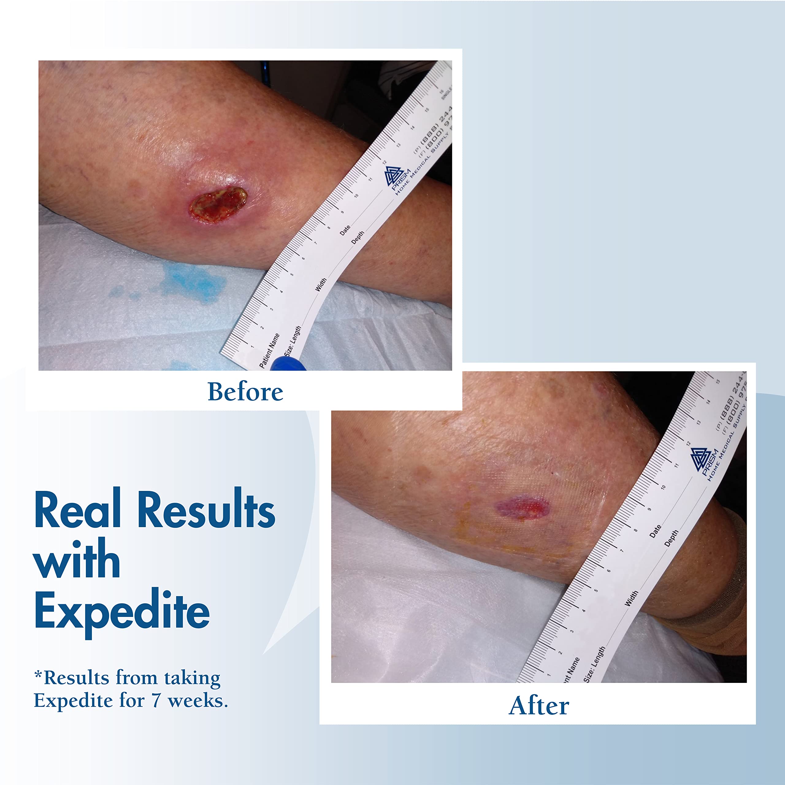 Mua Medtrition Expedite Liquid Collagen - 30x More Collagen Peptides ...
