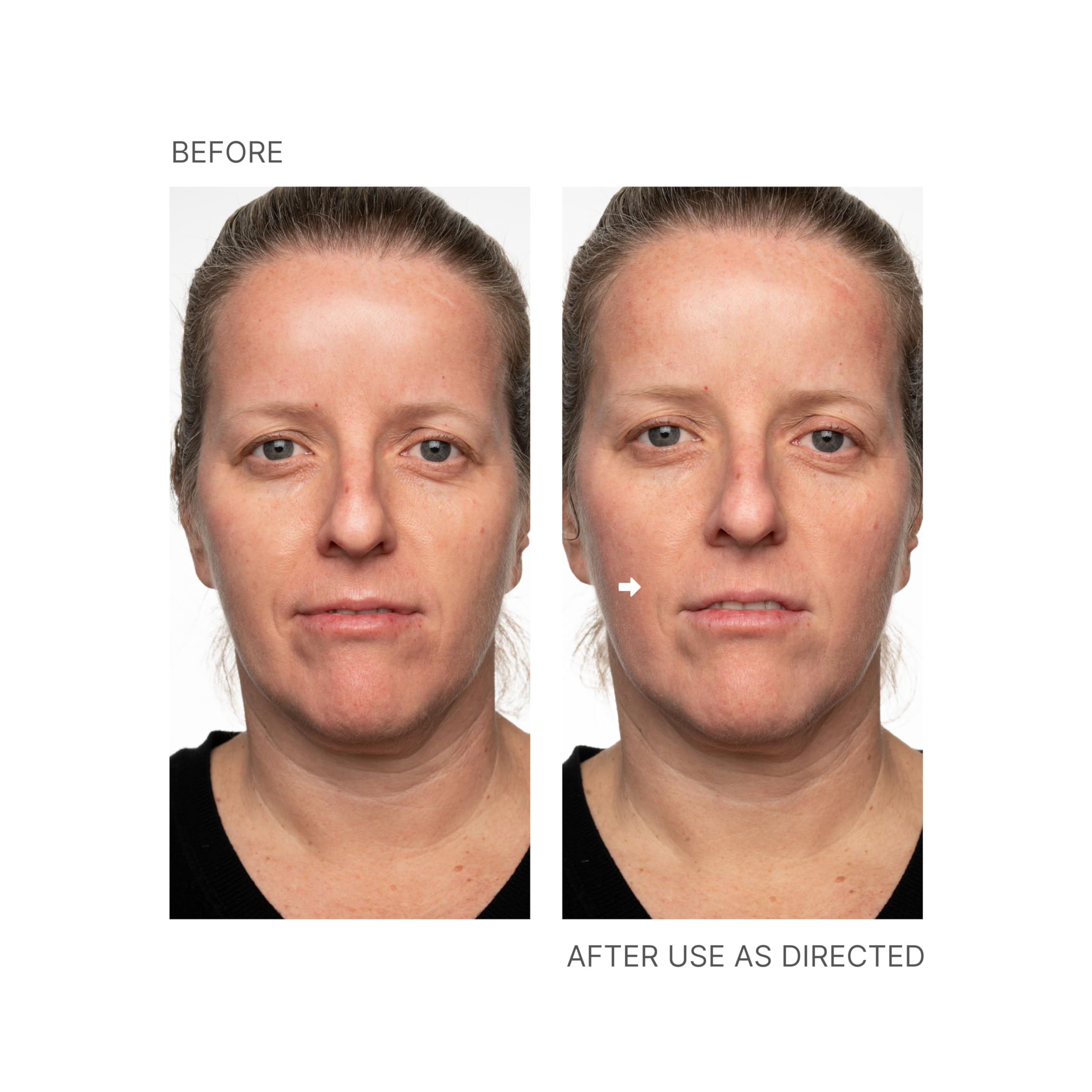 Mua Nu Skin - Face Lift with Activator (Original Formula) | Helps Lift ...