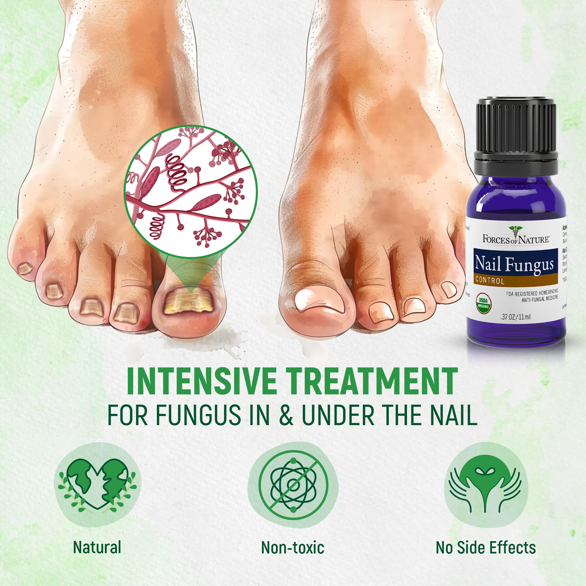 Mua Forces of Nature Toenail Fungus Treatment, 0.37 Fl Oz, Organic ...