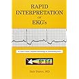 Rapid Interpretation of EKG's, Sixth Edition: Dubin, Dale ...