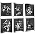 Amazon.com: Medical Decor set of 6 unframed Orthopedic Posters of Human ...