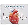 The 12-Lead ECG in Acute Coronary Syndromes: Phalen, Tim, Aehlert MSEd BSPA RN, Barbara J ...