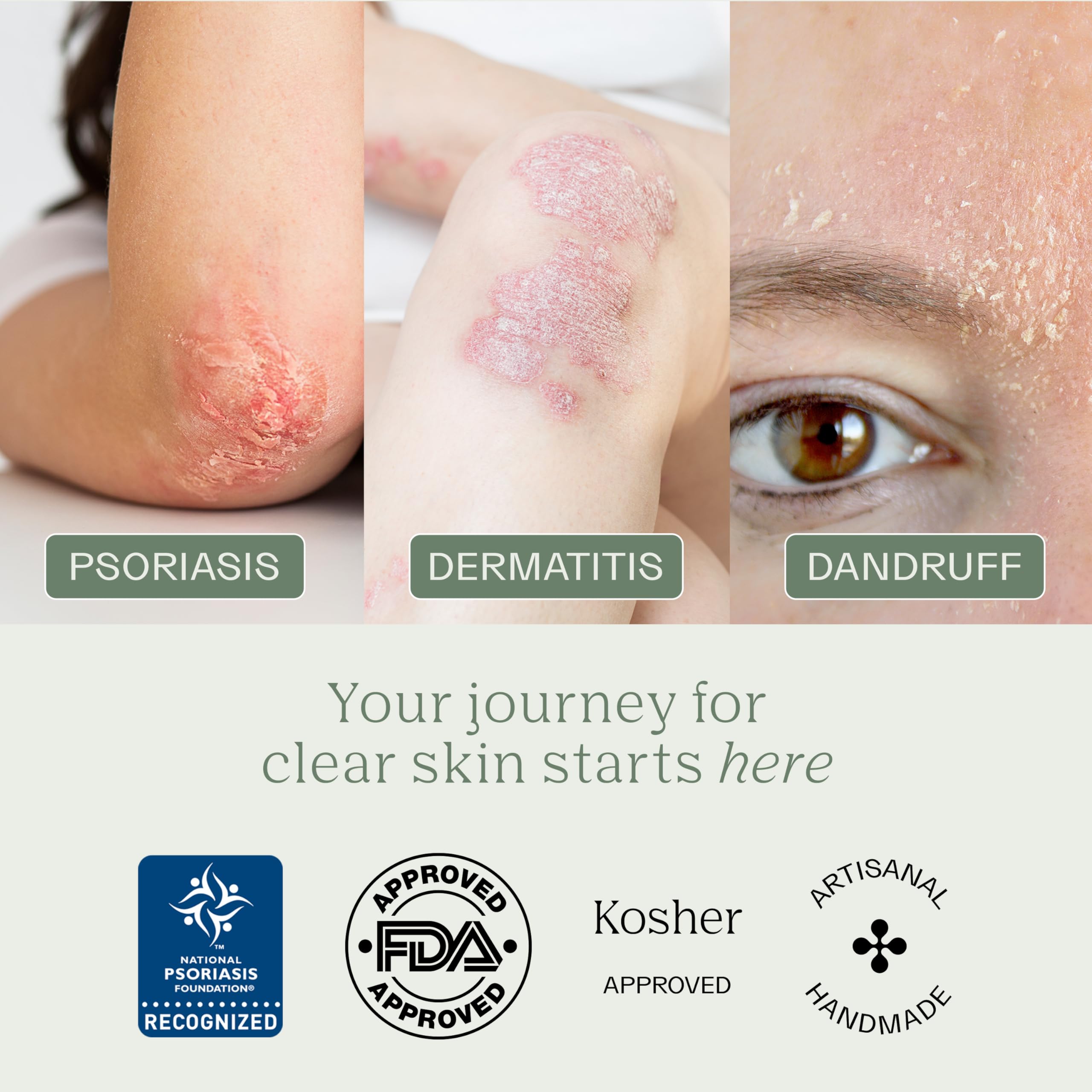 Mua Dermabon Psoriasis Cleanser, Seborrheic Dermatitis & Eczema Soap ...