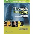 Thoracic Imaging: Pulmonary and Cardiovascular Radiology: 9781496321046: Medicine & Health ...
