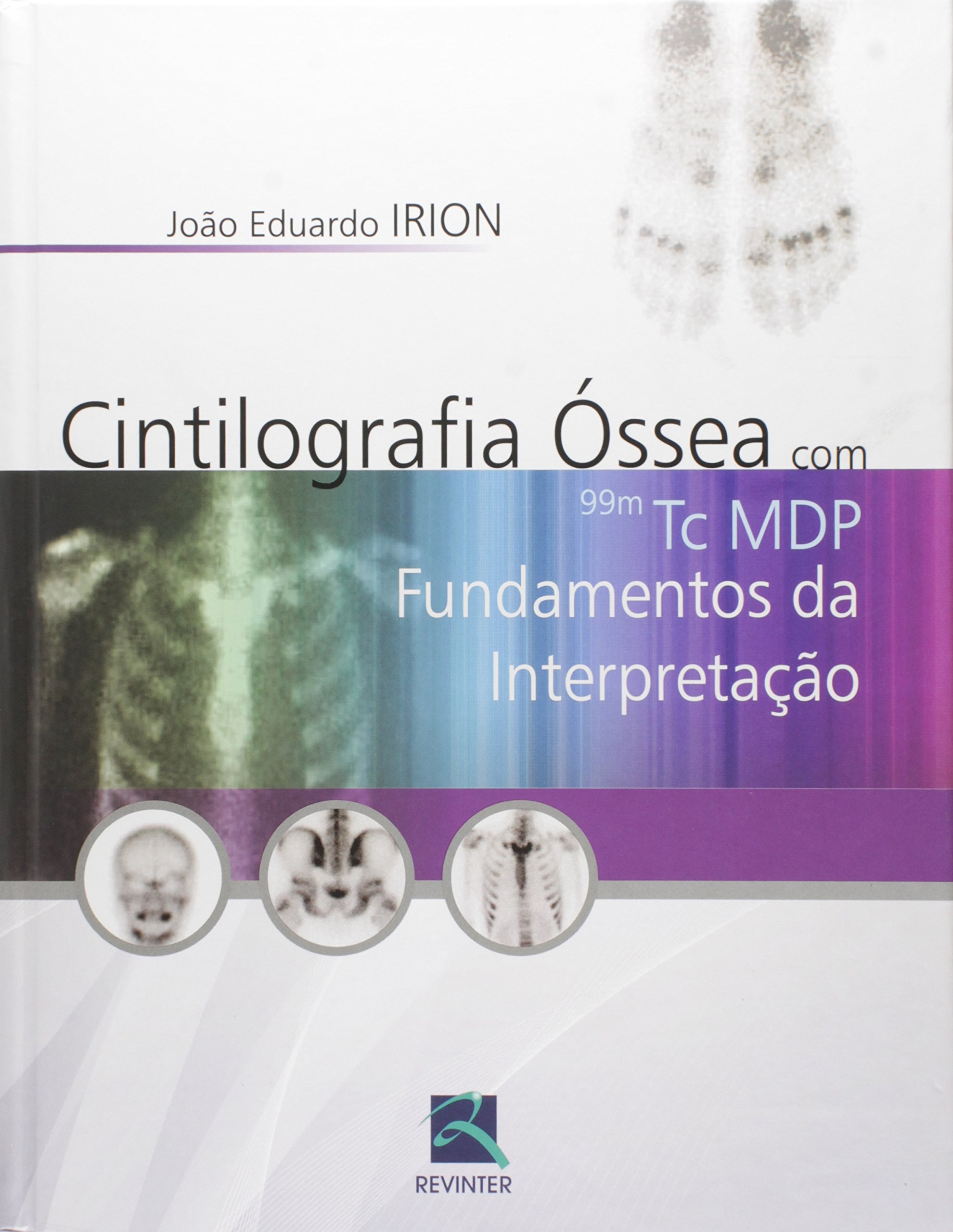 Cintilografia Óssea com 99m Tc MDP. Fundamentos da Interpretação PDF ...