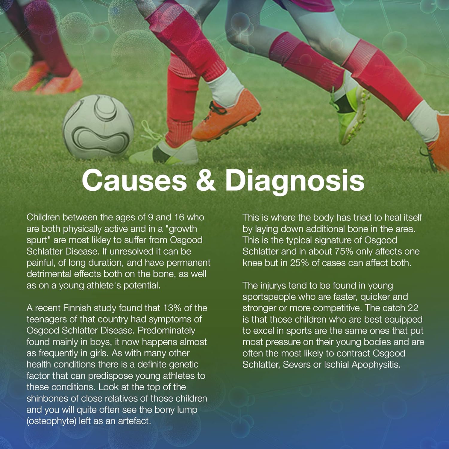 Oscon 60 Softgels – Osgood Schlatters Disease Supplement; Proven Osgood ...