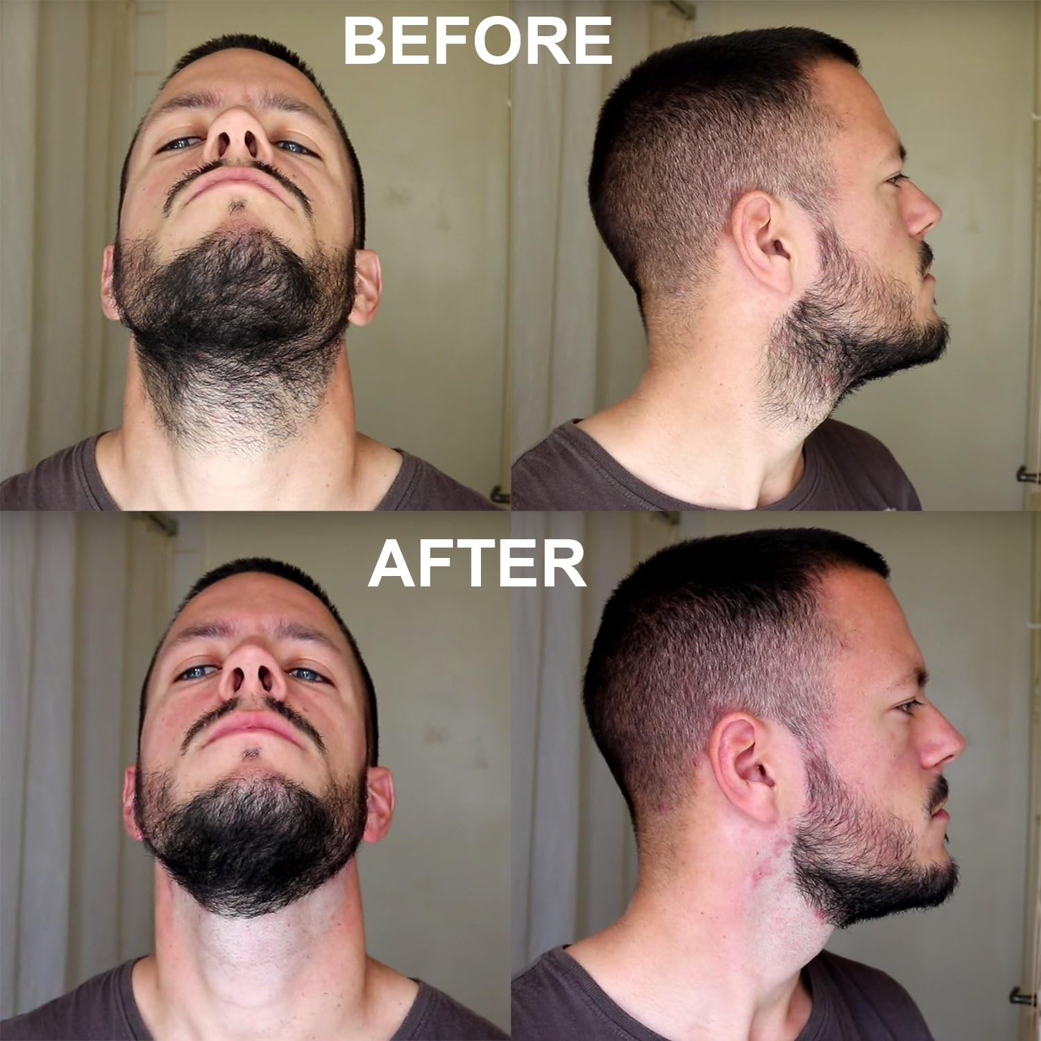 Aberlite Beard Shaping Tool – FlexShaper Neckline Shaper – Hands-Free ...