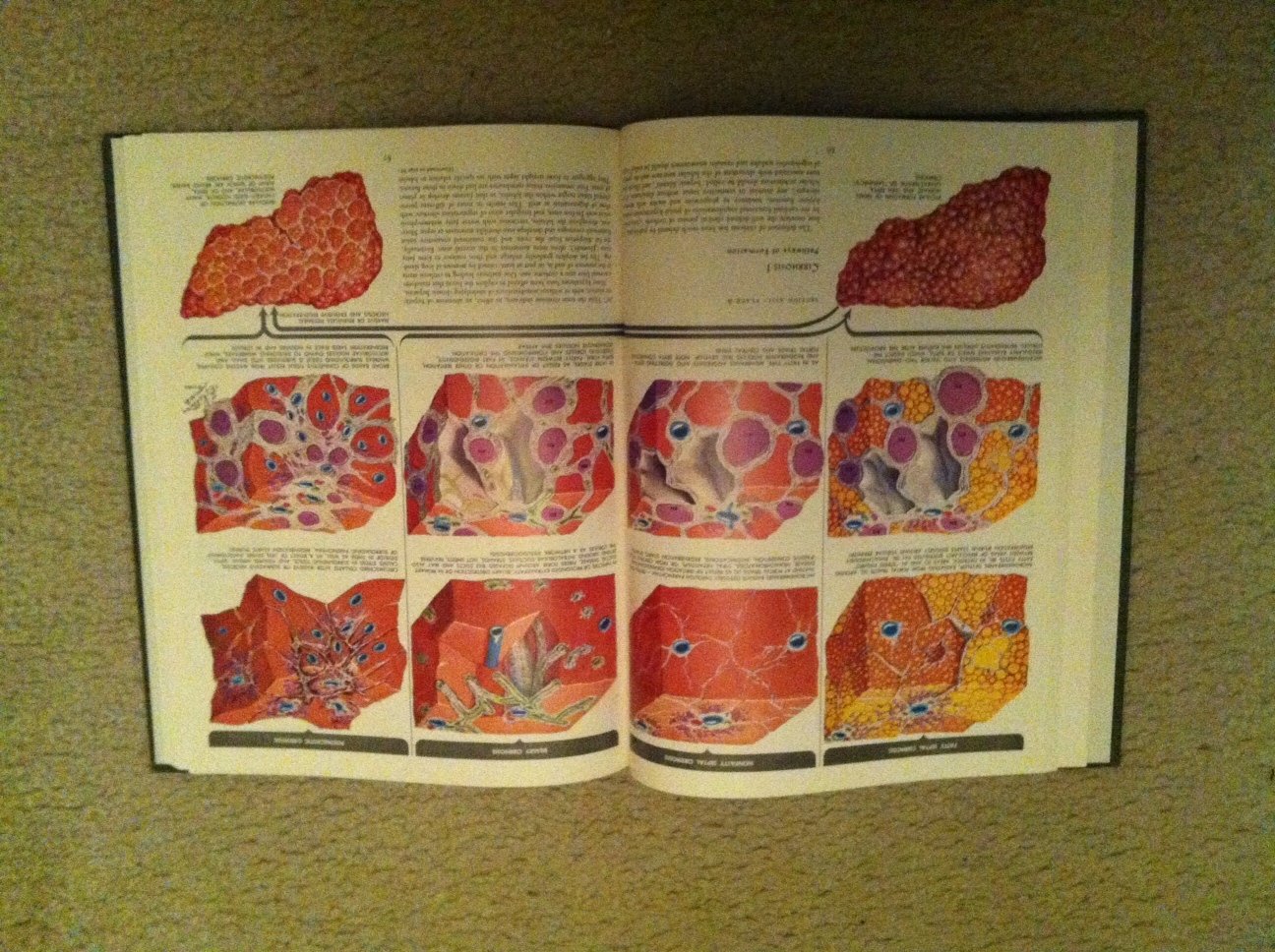 Mua The Netter Collection of Medical Illustrations - Digestive System ...