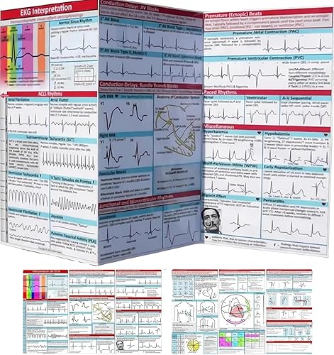 EKG Pocket Guide,EKG Rhythm Pocket Card, EKG Calipers Measuring Tool ...